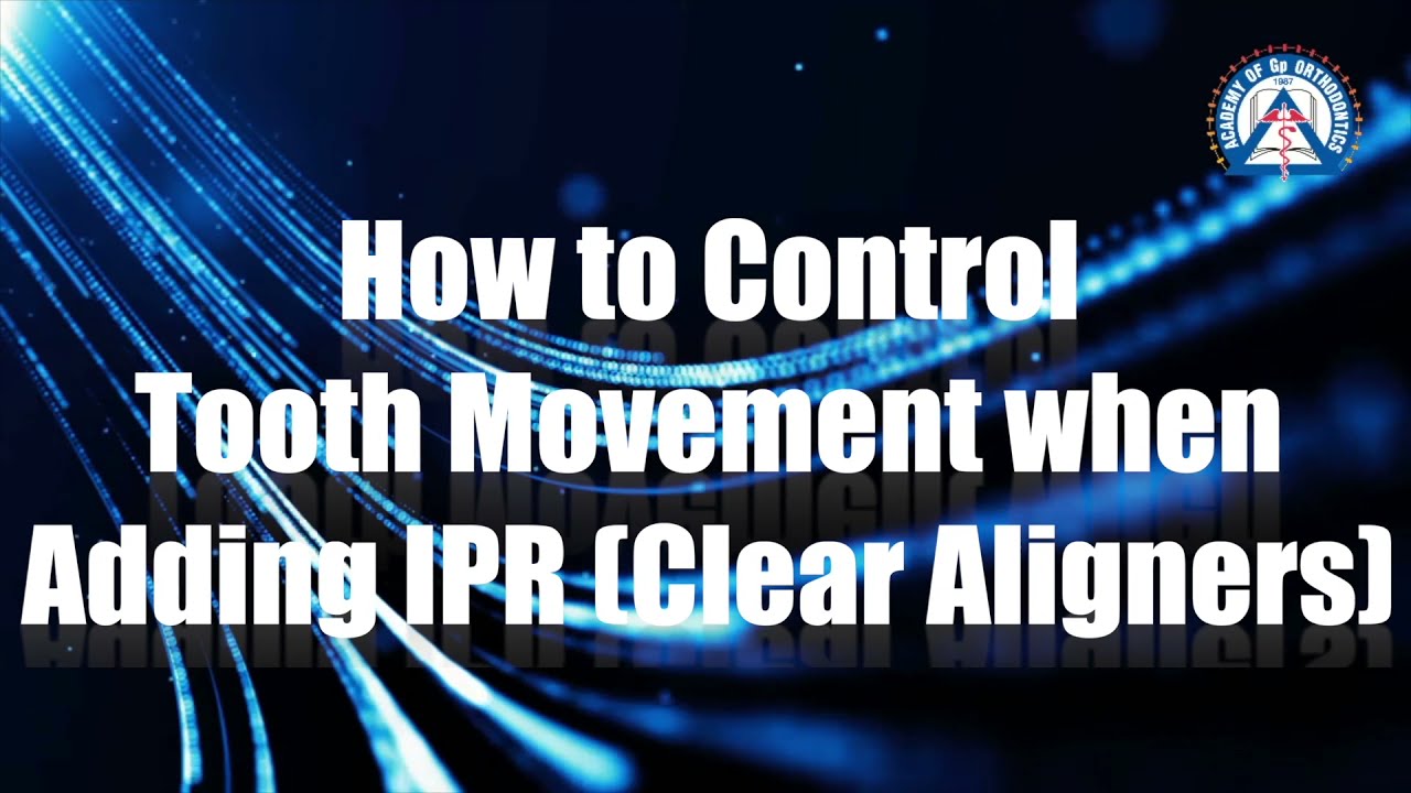Monday Tip: Controlling Tooth Position when Adding IPR in Clear Aligner ...