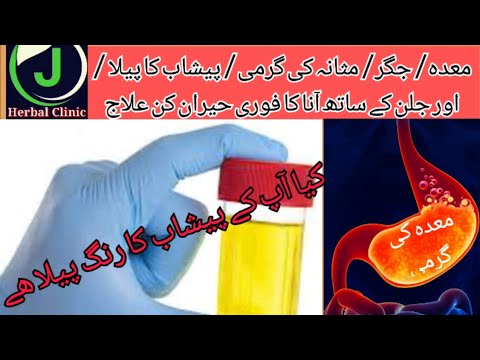 Meda Masana ki Garmi Pila Peshab Aana Peshab ka Ruk Ruk Kar Aana ka ...