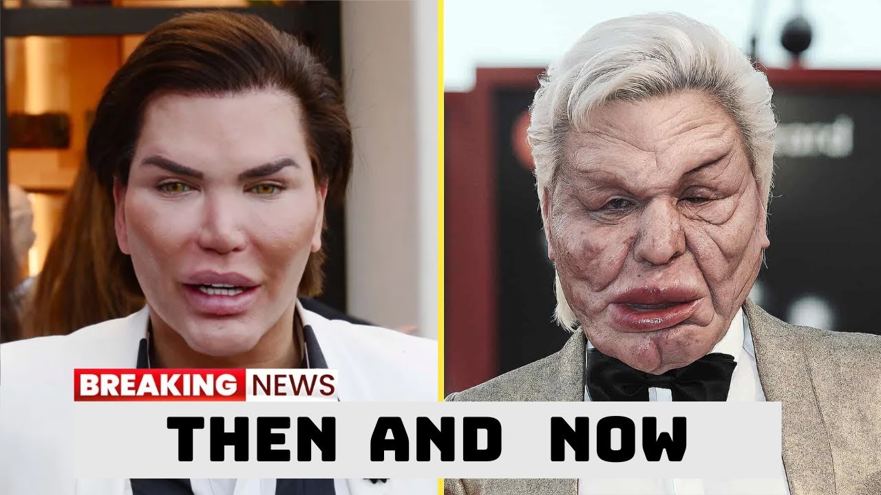 15 Celebrity Plastic Surgery Disasters That Will Shock You - YouTube