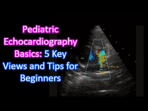 Pediatric Echocardiography Basics: 5 Key Views and Tips for Beginners ...