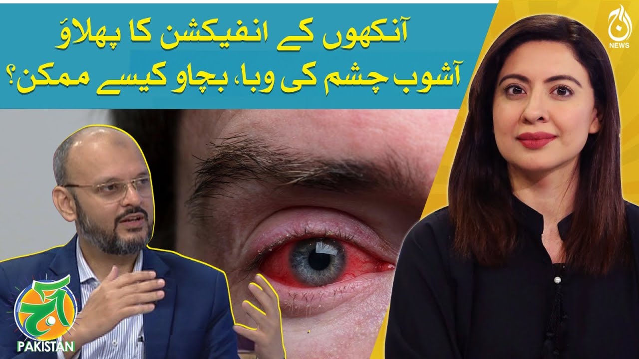 Increase in Eye Infection-Conjunctivitis Outbreak in Karachi ...