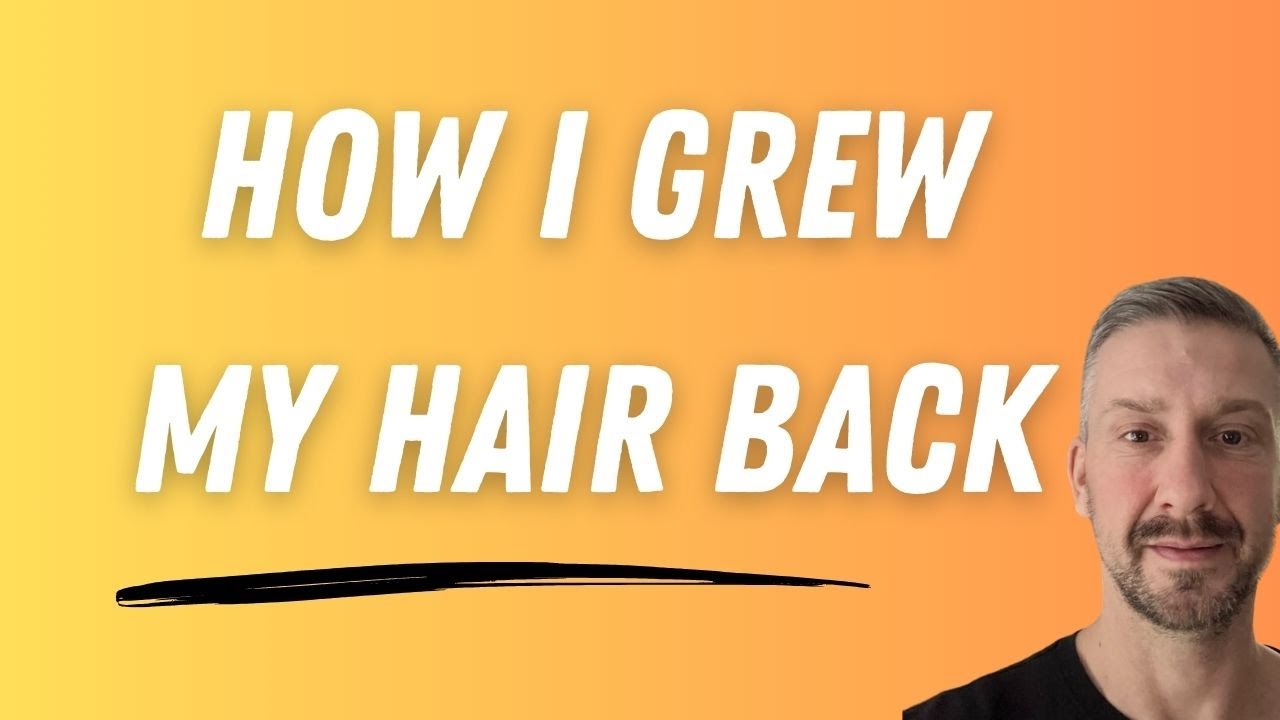 Hair Loss Protocol - How I grew my hair back - YouTube