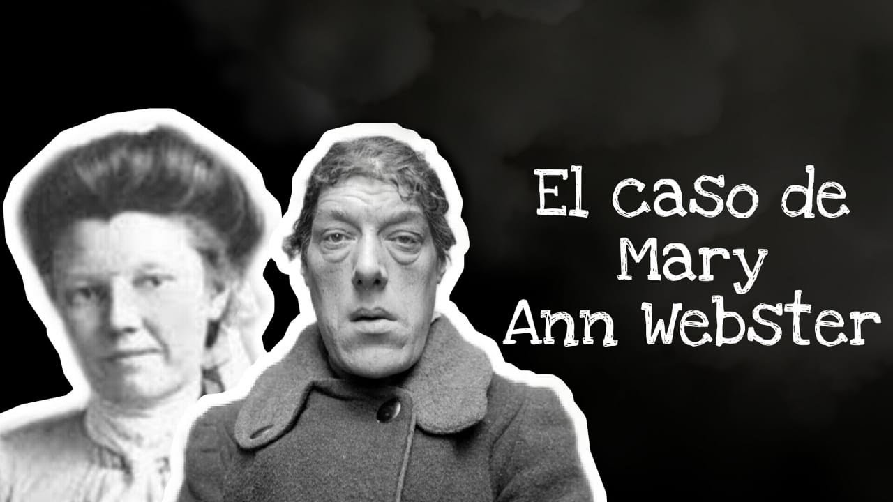 El caso de Mary Ann Webster | La mujer mas fea del mundo | Jolett - YouTube