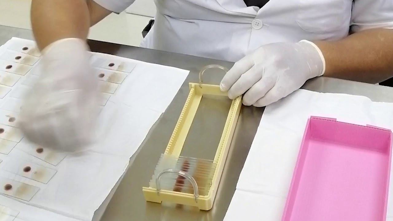 Staining ACD - YouTube