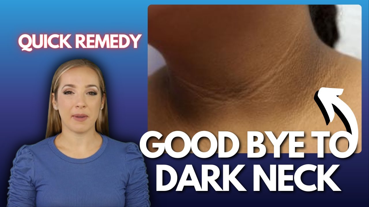 Dark Neck | Expert Tips for Removing Dark Neck | Causes, Signs ...