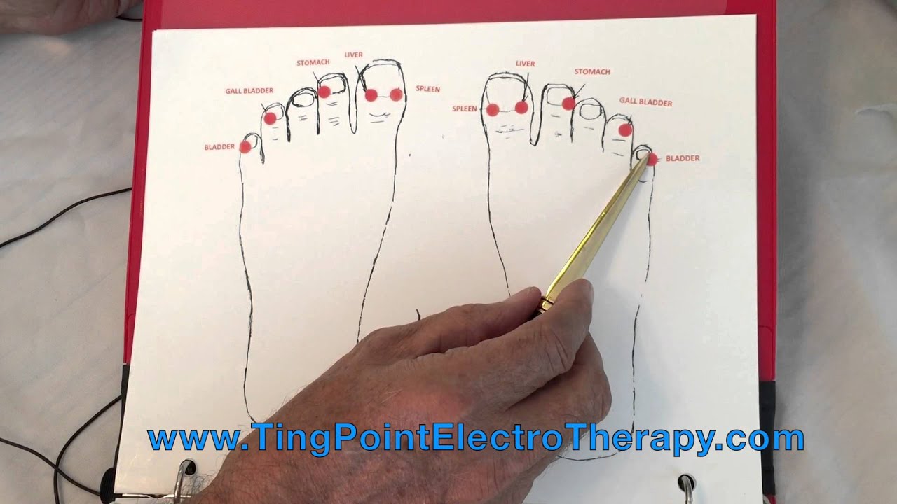 WHAT ARE TING POINTS - YouTube