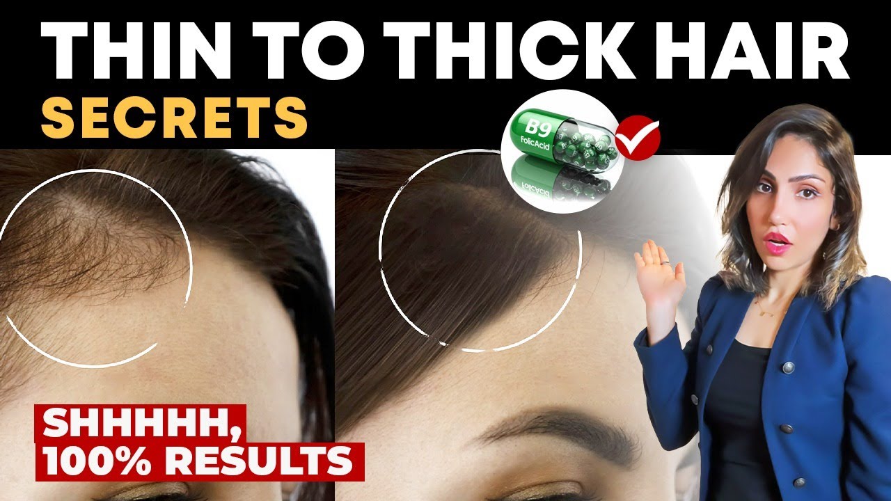 How To Stop Hair Loss Naturally Hair Loss का इलाज कैसे करें Youtube