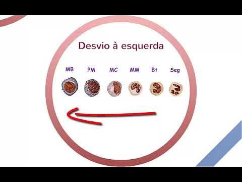 DESVIO À ESQUERDA NO HEMOGRAMA - Saiba como reconhecer, analisar e liberar no laudo - YouTube