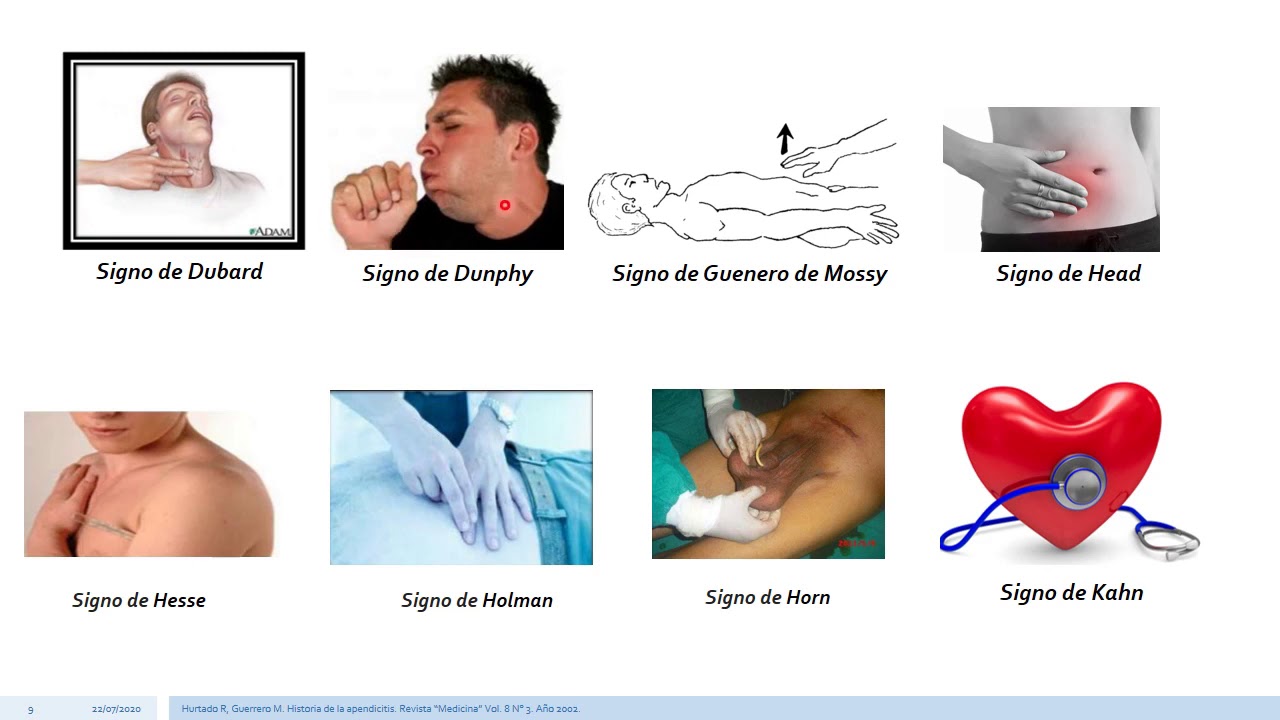 apendicitis parte 2 - YouTube