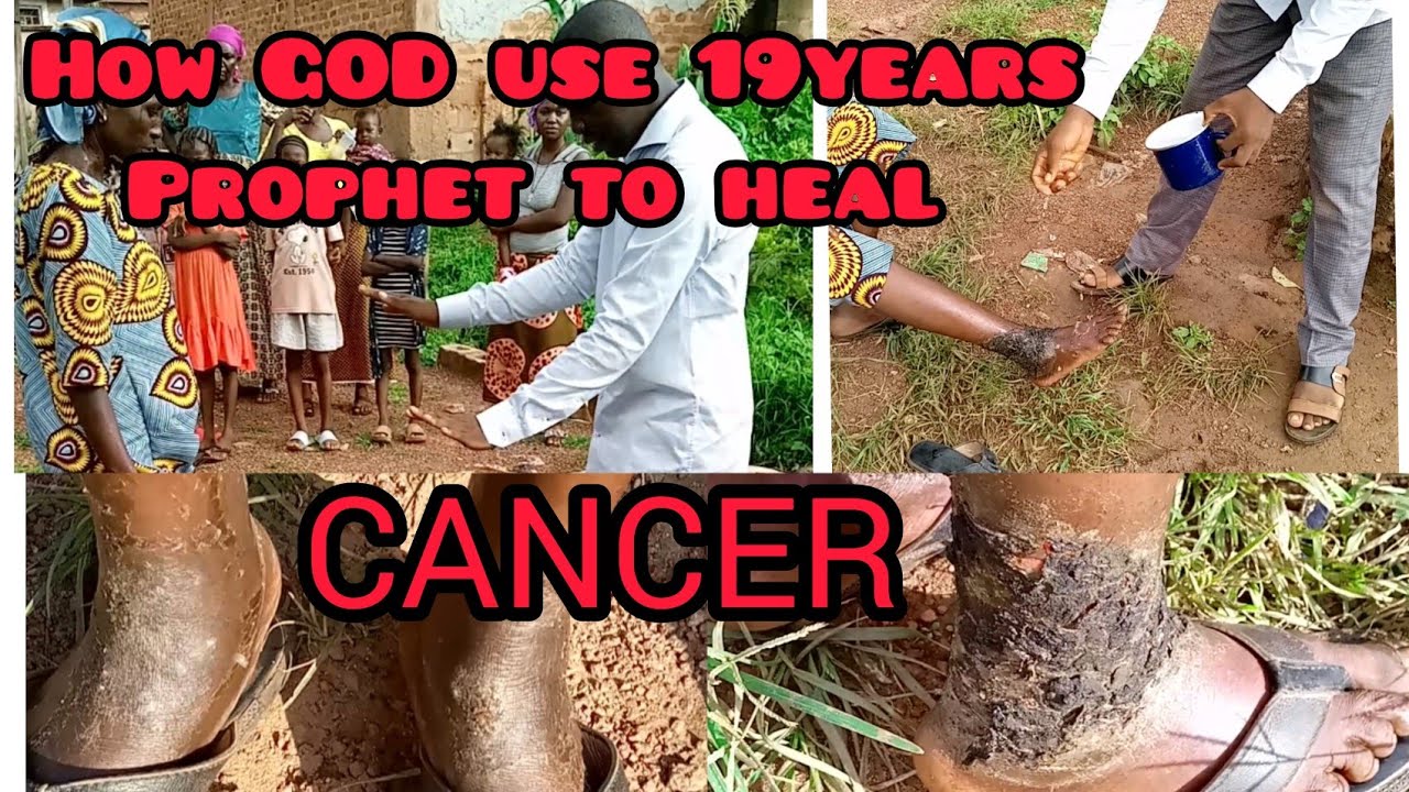 JESUS CHRIST HEALED A ROTTEN LEG | CANCER - YouTube