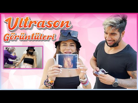 BEBEĞİMİZİN ULTRASON GÖRÜNTÜLERİ (CİNSİYETİ BELLİ OLDU MU?)