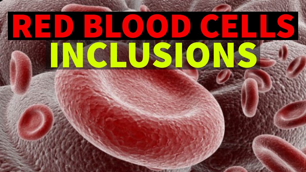 RED BLOOD CELLS - INCLUSIONS | Dr.Sonu Yadav | Pathology Kingdom ...