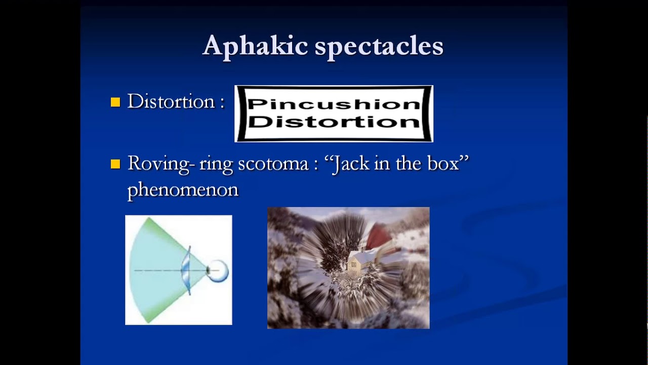 OPHTHALMOLOGY - TOPIC - APHAKIA - YouTube