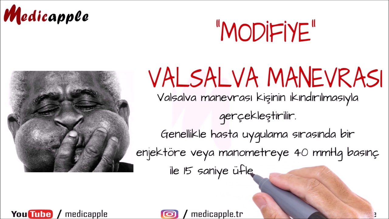 VAGAL MANEVRALAR - YouTube