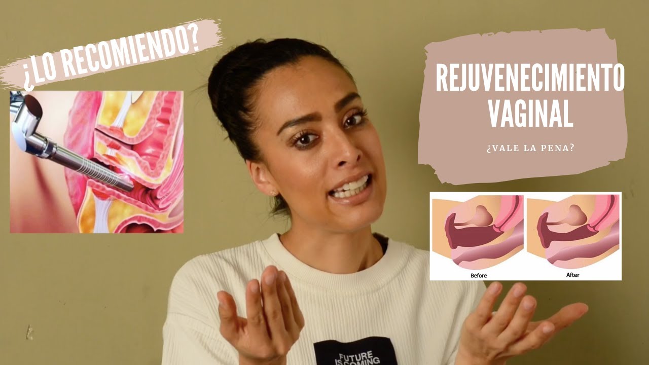 HIFU v*ginal: Todo lo que necesitabas saber - YouTube