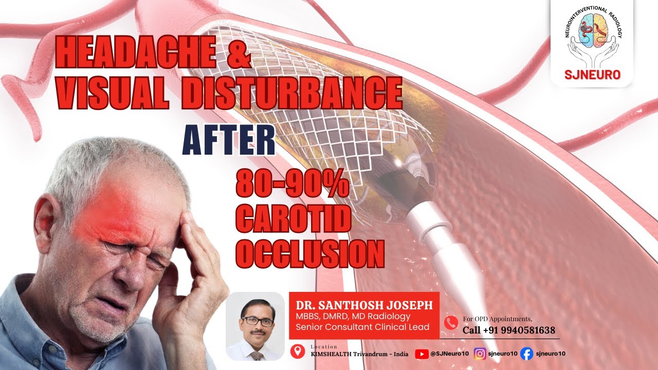 Headache & Visual Disturbance Due to 80–90% Carotid Artery Occlusion ...