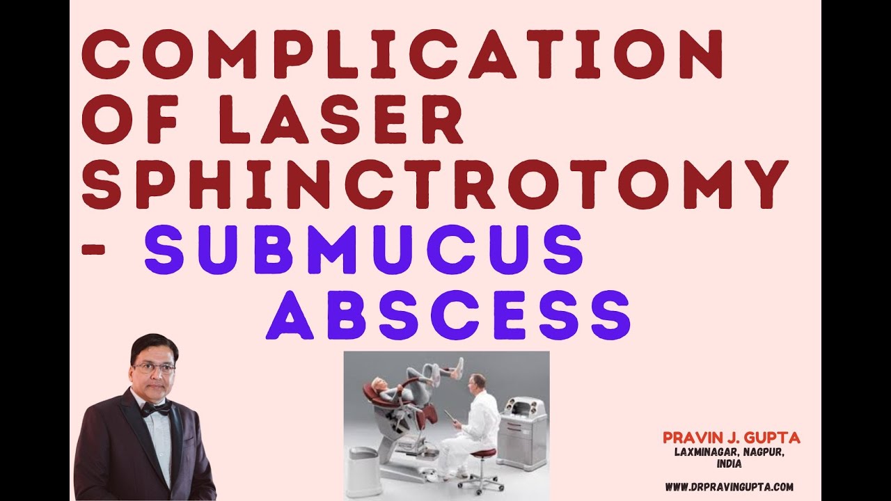 COMPLICATION OF LASER ANAL SPHINCTEROTOMY- ABSCESS OF THE ANAL CANAL ...