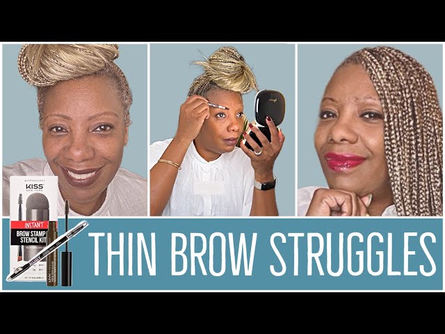 Unnatural Eyebrows Artificial Eyes | Prosthetic Eye Specialists