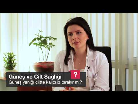 Güneş yanığı ciltte kalıcı iz bırakır mı?