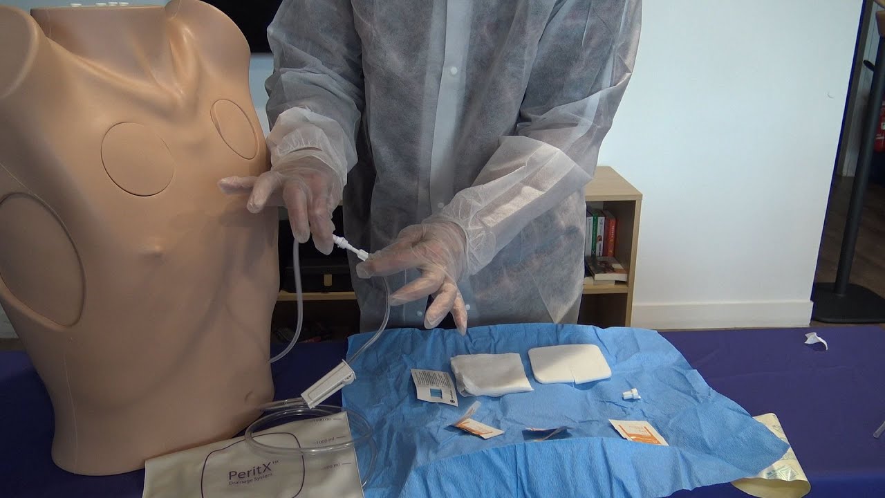 Système de drainage d’ascites PeritX - YouTube