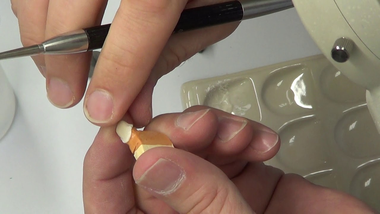 Porcelain Margin Adjustment Build YouTube porcelain-margin-adjustment-build-youtube