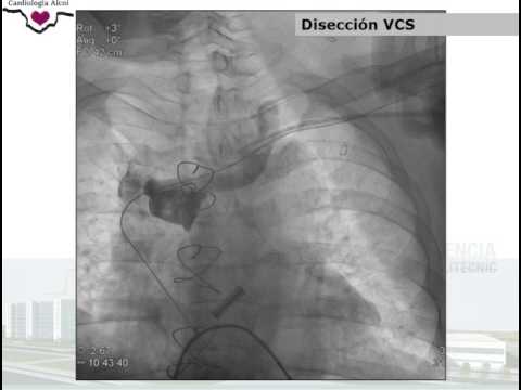 Formación — Sociedad Valenciana de Cardiología