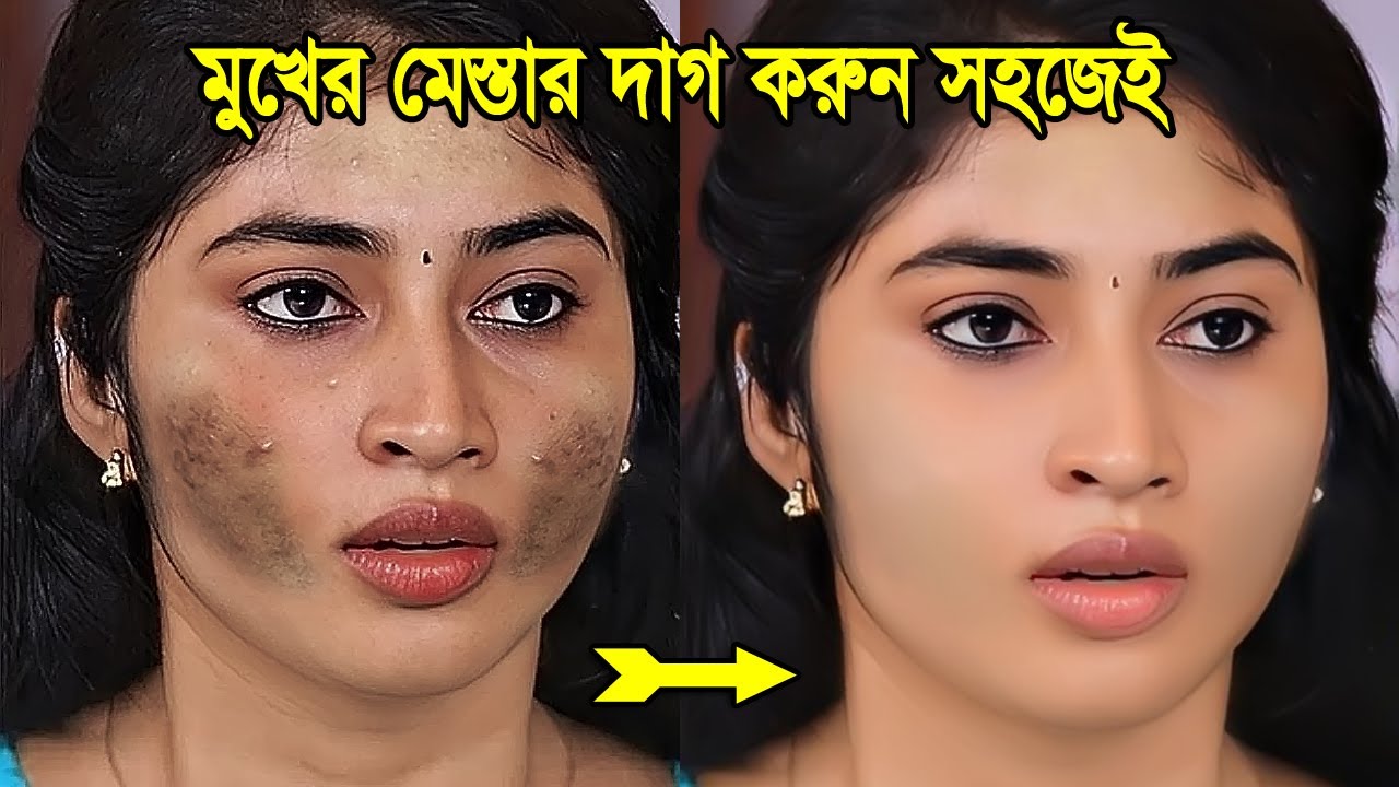 How to Face Screen Smooth High End Skin Retouching Photoshop Tutorial ...