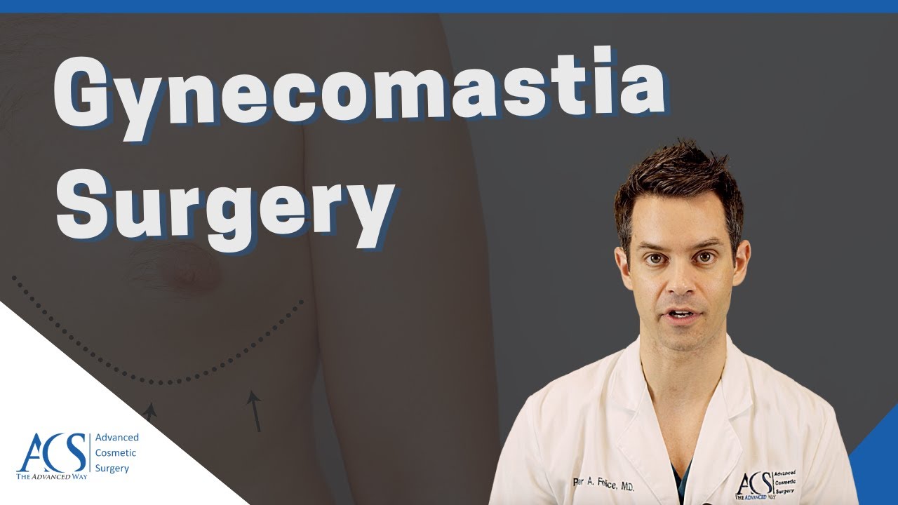 Gynecomastia Surgery: What It Is, Best Candidates, the Consultation ...