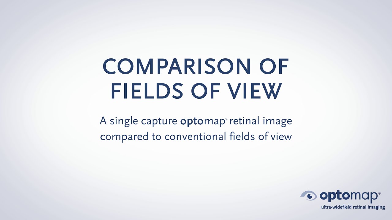 Optomap Comparison of Fields of View Animation - YouTube