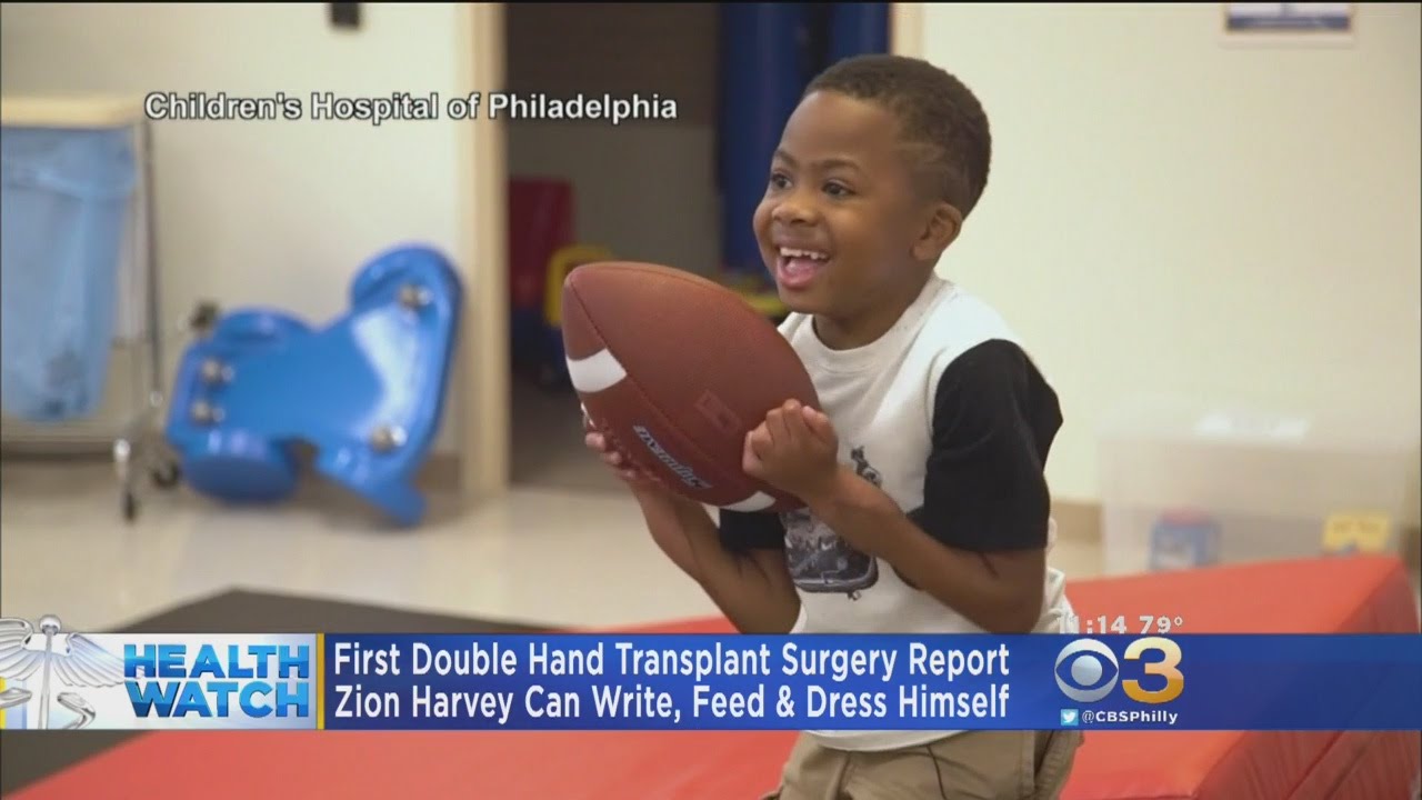 Boy Thriving After Receiving First Double Hand Transplant Surgery - YouTube