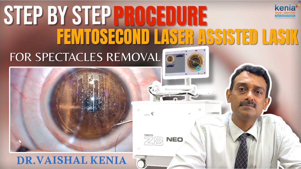 Femtosecond Laser Assisted Lasik For Spectacles Removal - YouTube