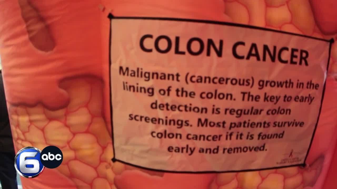 Tour Nolan the Rollin' Colon - YouTube