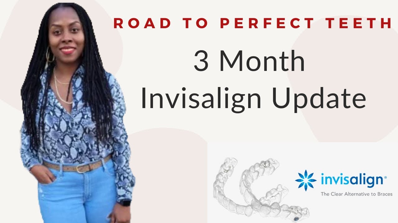 My Invisalign Journey 3 Month Update| What You Should Know | Invisalign ...