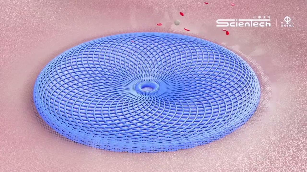 MemoSorb Degradable Occluder System - YouTube