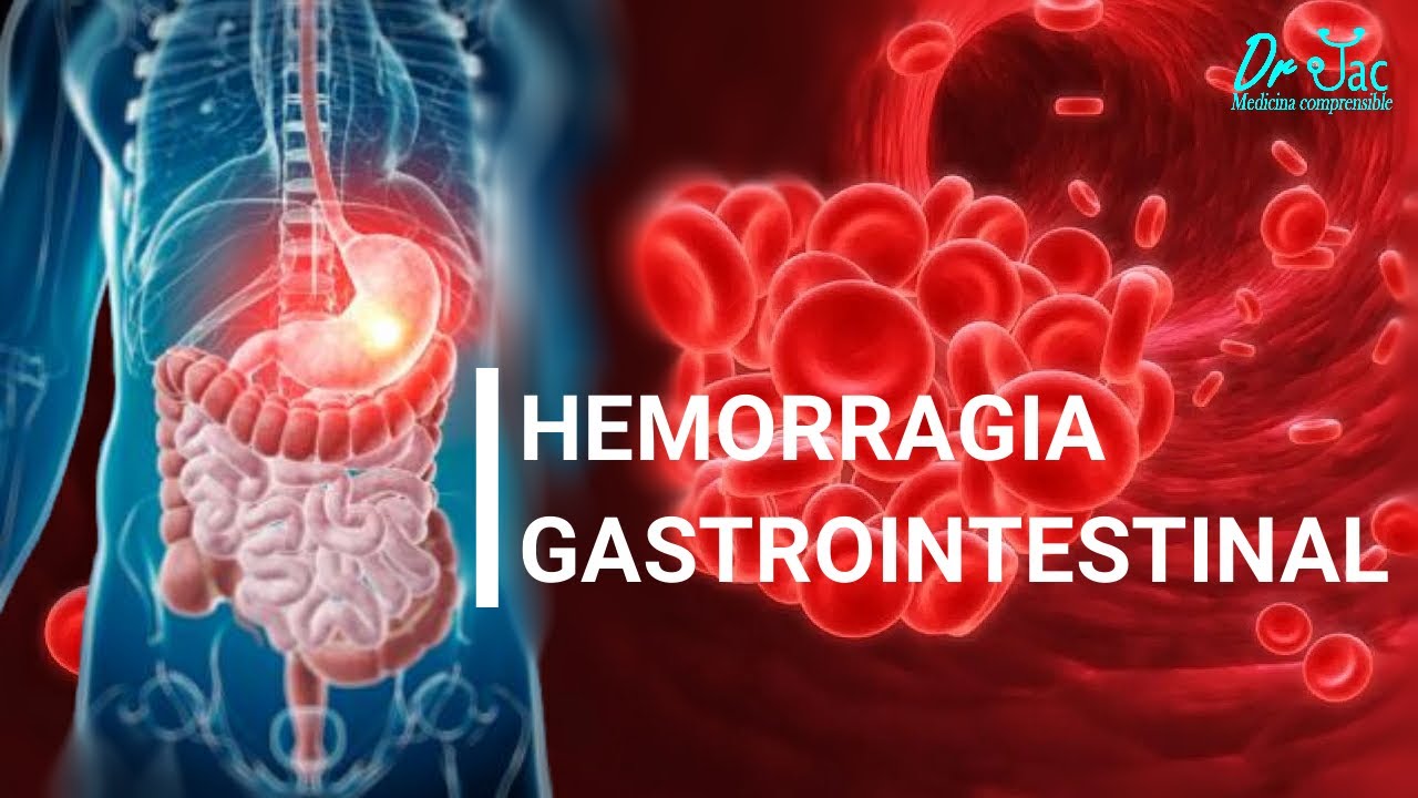 Hemorragia gastrointestinal - YouTube