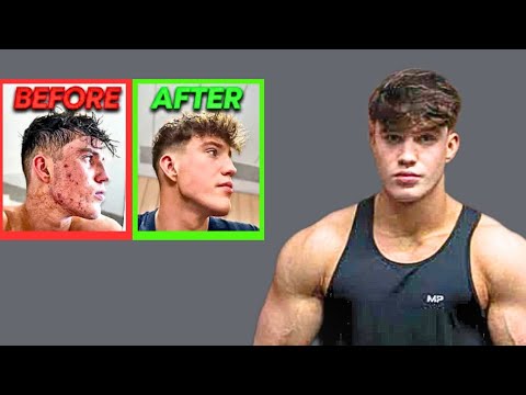 How A Bodybuilder ACTUALLY Fixes Acne - YouTube