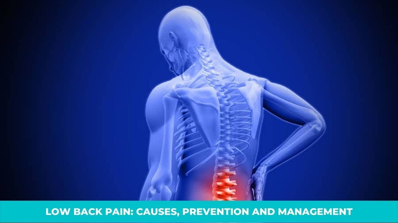 LOW BACK PAIN: CAUSES, PREVENTION AND MANAGEMENT - YouTube