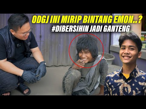 ODGJ MIRIP BINTANG EMON - KOK BISA..? PAS DIBERSIHIN JADI GANTENG BANGET, COCOK JADI PELAWAK