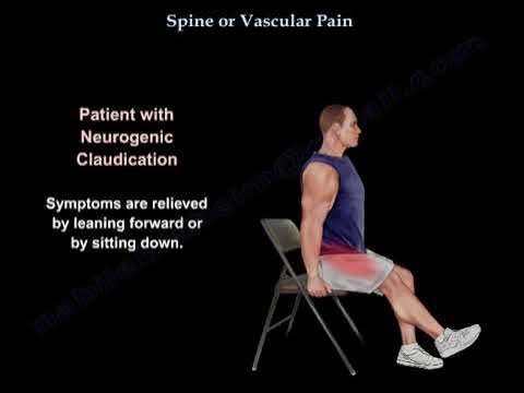 Spine or Vascular issues? - Everything You Need To Know - Dr. Nabil ...
