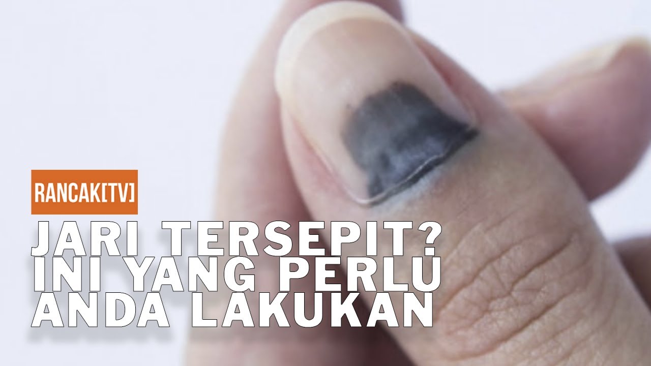 POV: Jari tersepit? Ini apa yang anda perlu tahu - YouTube