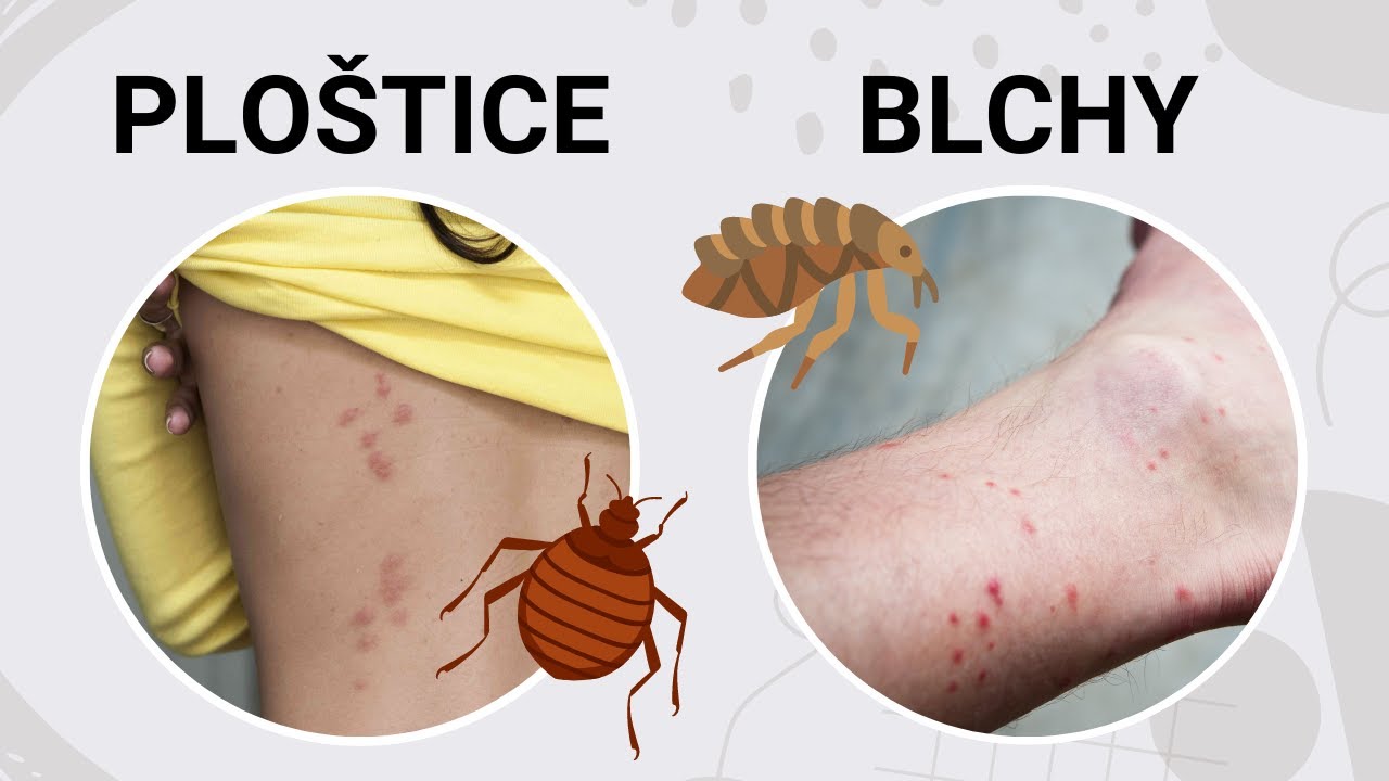 Ako identifikovať štípance od ploštice? - YouTube