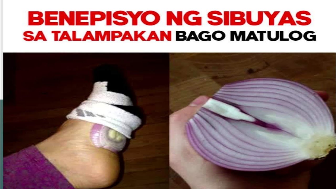 ITO ANG BENEPISYO NG PAGLAGAY NG SIBUYAS SA LOOB NG MEDYAS SA PAA NA ...