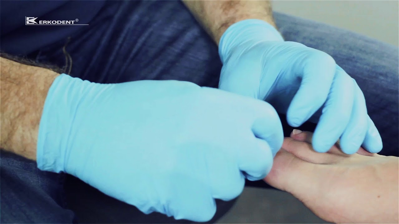 ERKODENT Ortho Erkitechnik - YouTube