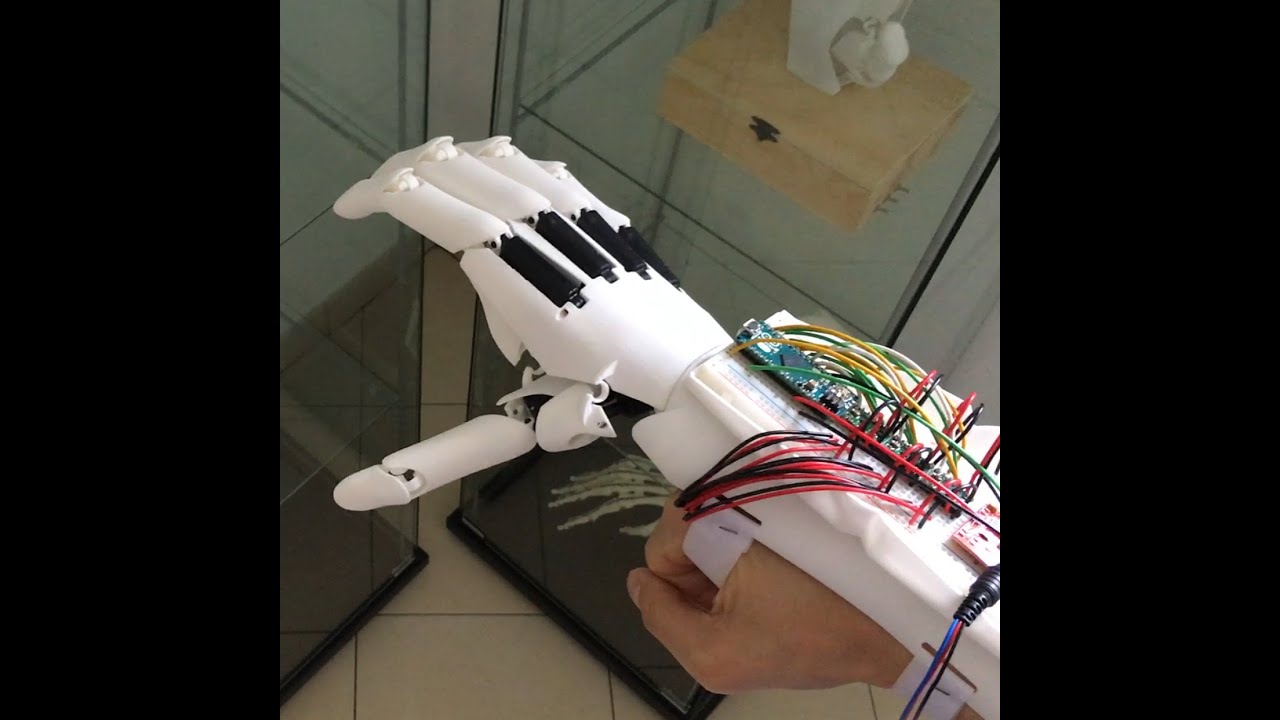 Youbionic Hand First Rise - YouTube
