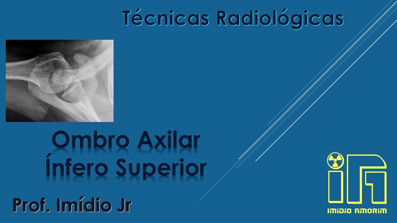 Ombro Axilar ou Axial - Súpero Inferior - YouTube