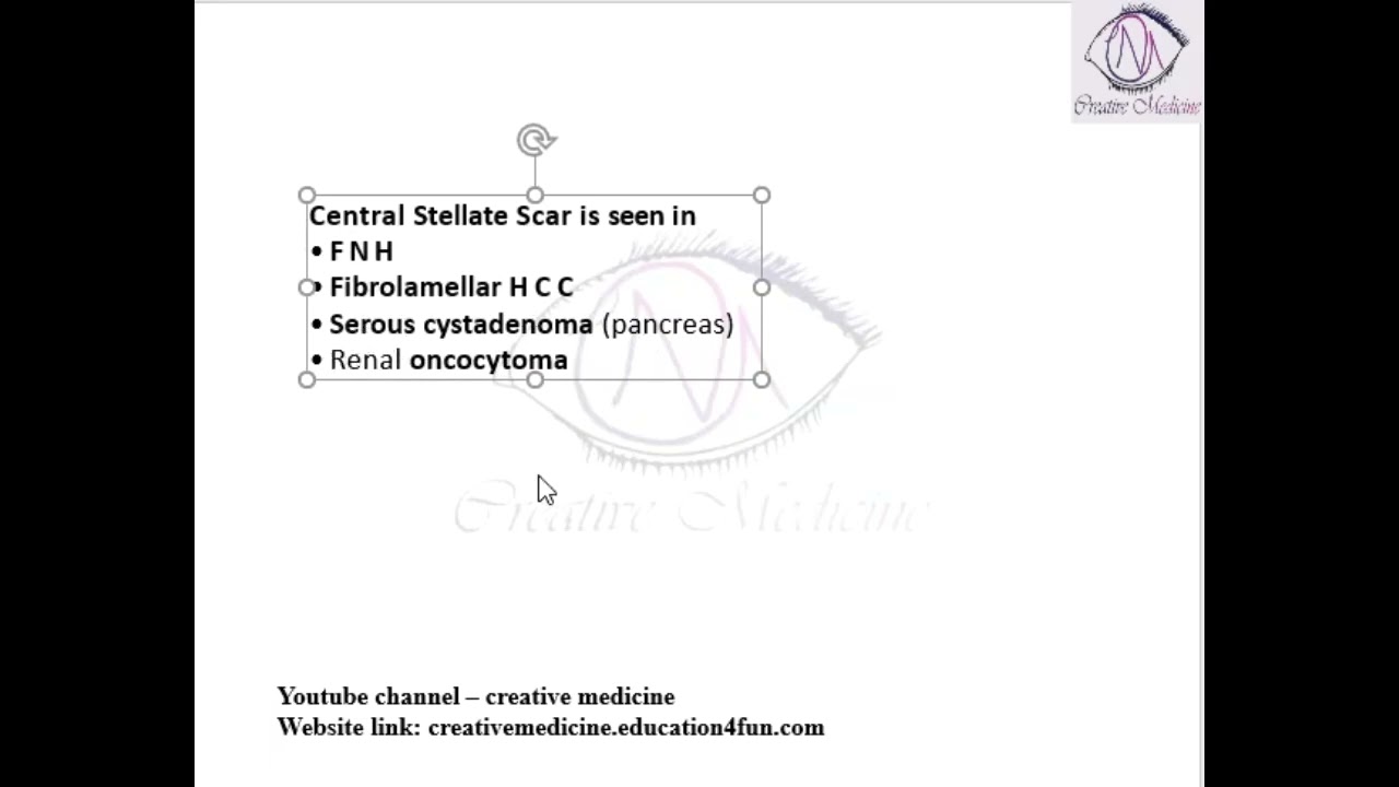 Lec 3 Oncocytoma Central Stellate Scar Differential Diagnosis - YouTube