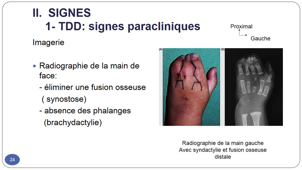 kouna tsala, cours syndactylie - YouTube