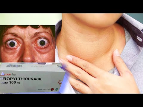 Informasi Obat PTU 100 mg (Propylthiouracil) untuk pengobatan Kelebihan ...