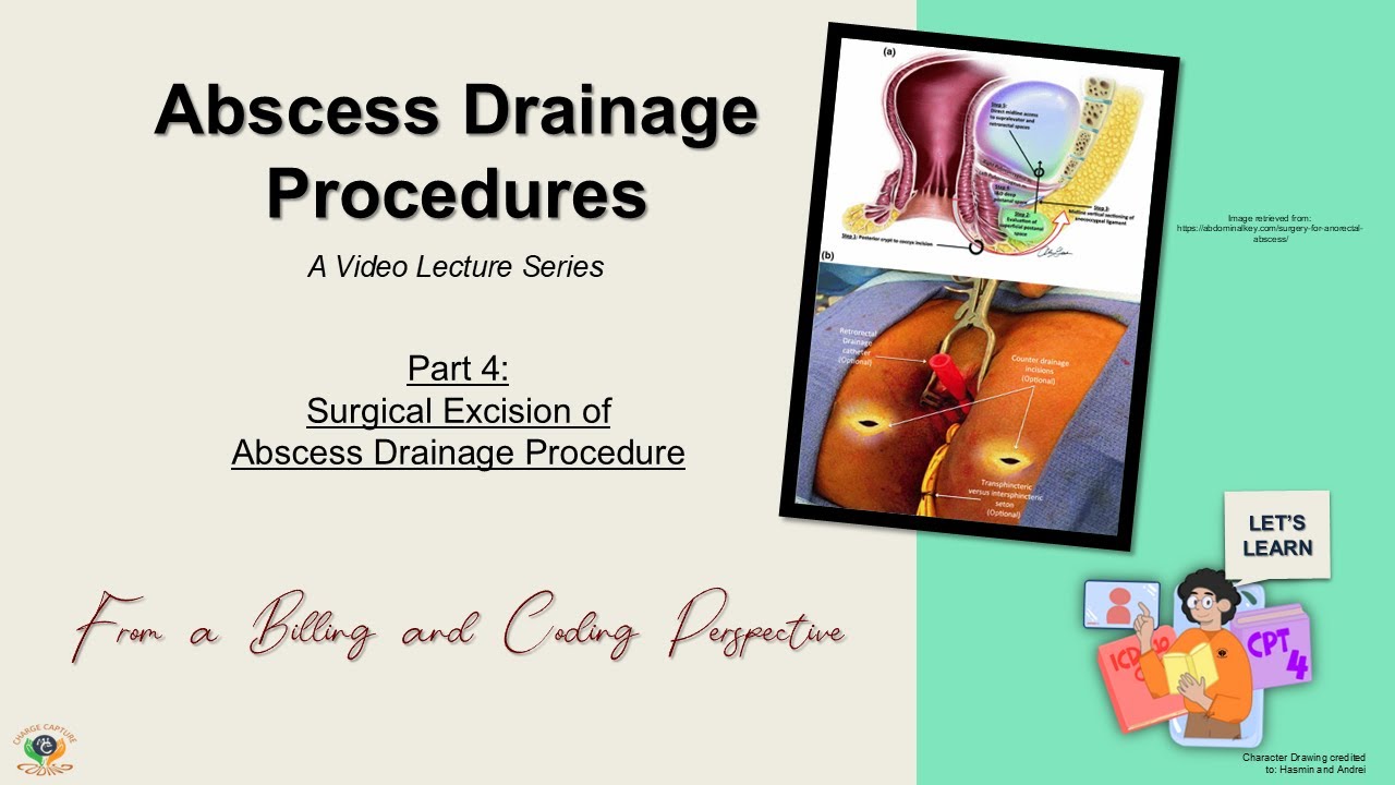 Episode 16: Abscess Drainage Lecture Series - Part 4 of 4 (Surgical ...