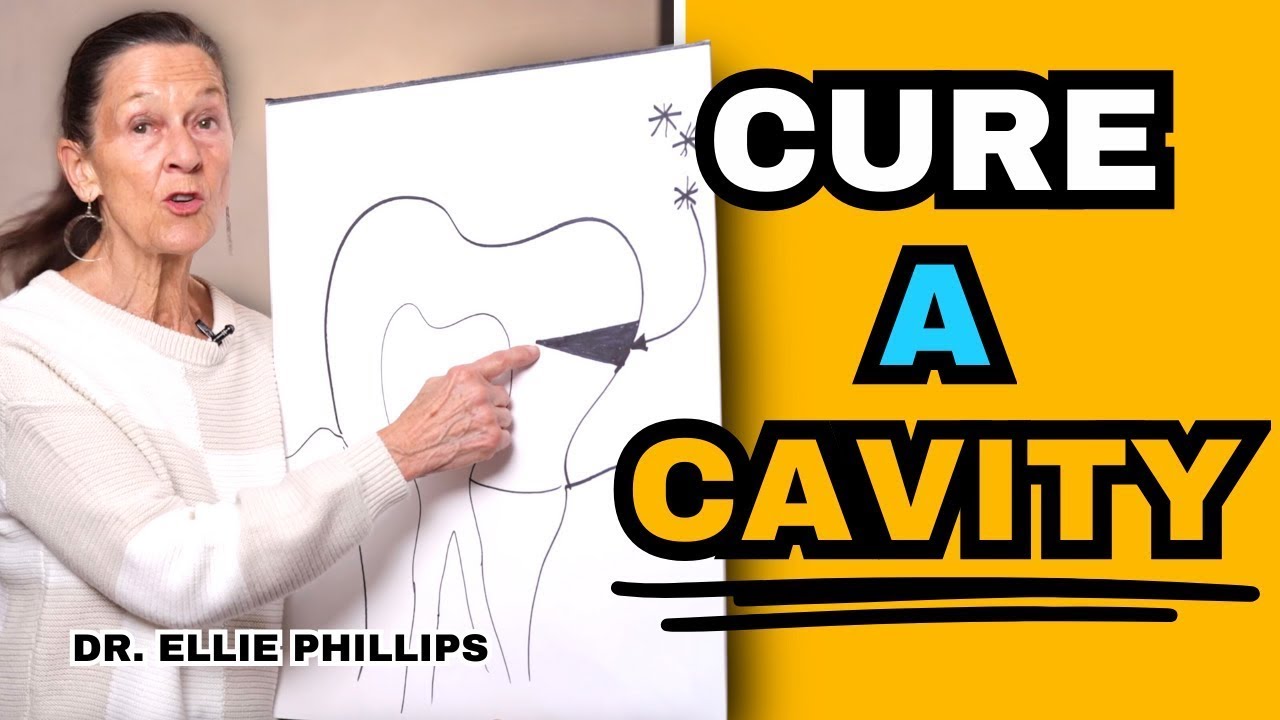Reverse a Cavity w/ This Easy System and Avoid Fillings Forever - YouTube